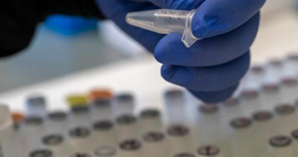 CU Anschutz researchers roll out antibody test | CU Connections